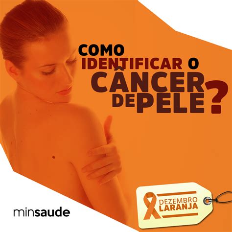 Como Identificar O Câncer De Pele Inca Instituto Nacional De Câncer