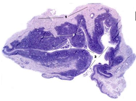 14 Palatine Tonsil He Flashcards Quizlet