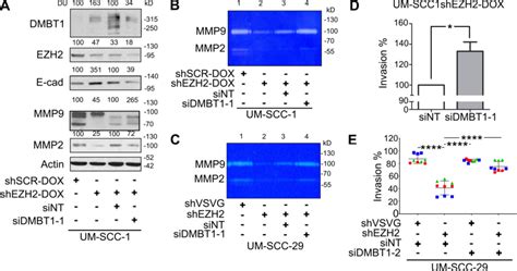 Suppression Of Dmbt1 Down Regulates E Cadherin E Cad Up Regulates