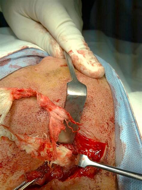 Extraction Of The Sponge Download Scientific Diagram