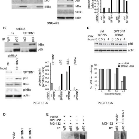 Loss Of SPTBN1 Promotes Hepatocarcinogenesis And Inflammatory Through