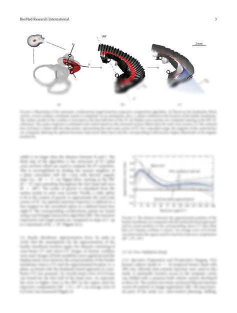 Solution Semiautomatic Cochleostomy Target And Insertion Trajectory Planning For Minimally