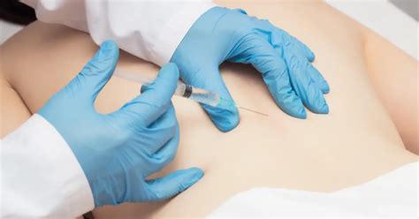 What Happens Before And After A Facet Joint Injection