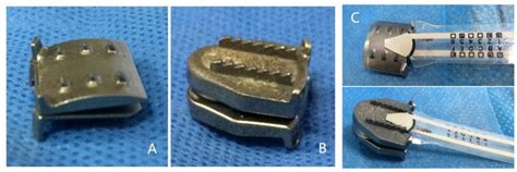 The Prostheses A The Novel Cervical Artificial Disc Prosthesis Based