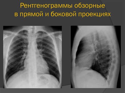 Схема описания рентгенограммы легких презентация онлайн