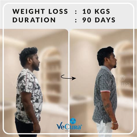 Best Weight Loss Treatment In Visakhapatnam Vecura Wellness