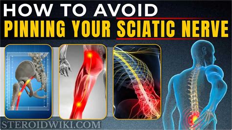 How To Avoid Pinning Your Sciatic Nerve Its Causes Solutions And P