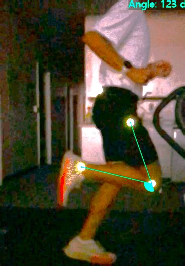 Hip Bursitis What You Need To Know