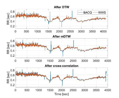 Aligned Rr Signals From Bacq And Wws After Dtw Mdtw And Download