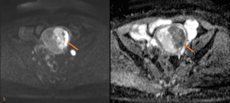 Radiology Manipal Hospital
