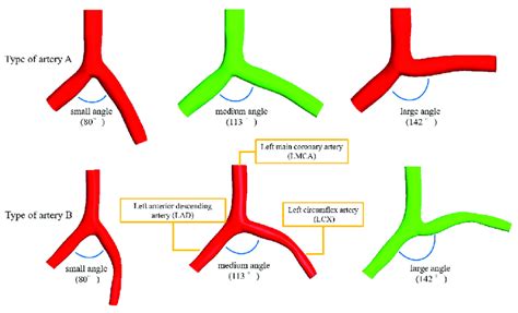 The Models Of The Left Coronary Bifurcation Arteries Two Types Of