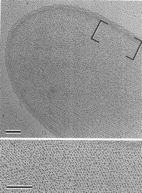 Electron Micrograph Of A Cell Envelope Fragment Treated With Triton