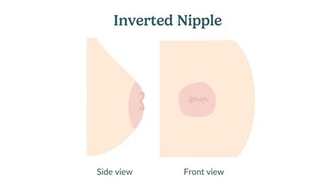 Inverted Nipple Breastfeeding Glossary By The Lactation Collection