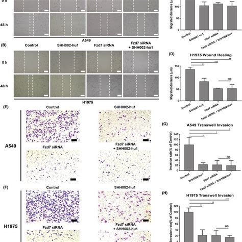 Shh002‐hu1 Inhibits The Migration And Invasion Of A549h1975 Cells A