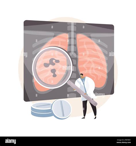 Lower Respiratory Infections Abstract Concept Vector Illustration Stock