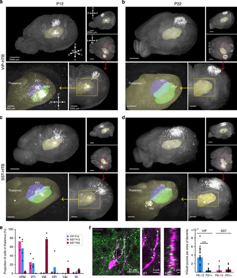 Rearrangement Of Thalamic Inputs Onto Superficial Vip⁺ And Sst