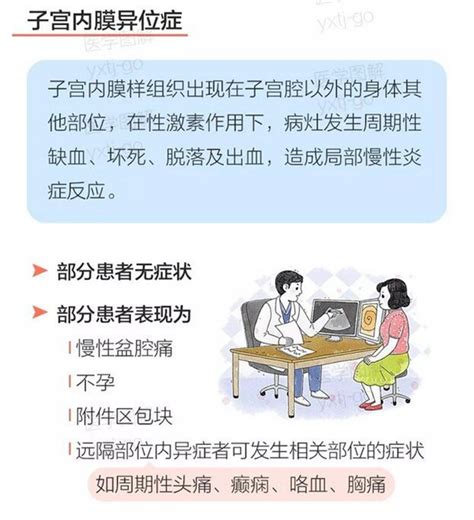 内异症与不孕症的恩恩怨怨