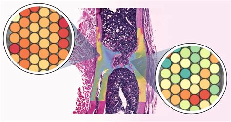 Bones Respond Positively To External Forces