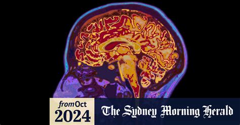 Are Left Wing And Right Wing Brains Wired Differently