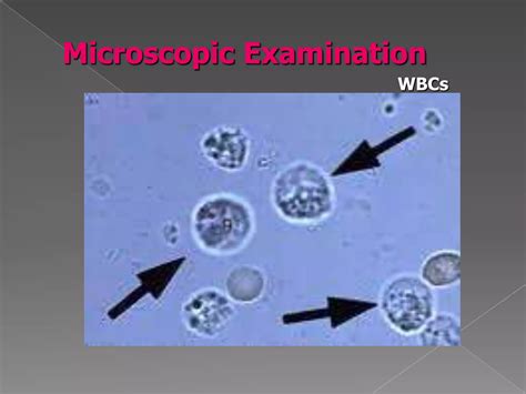 Microscopic Examination Of Urine Pptx