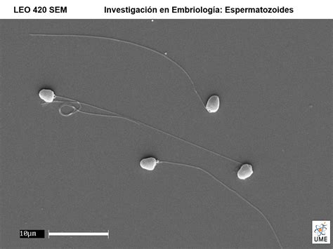 LEO 420 Scanning Electron Microscope Unidad De Microscopia