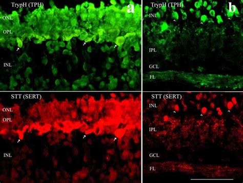 High Power Photomicrographs Of Two Vertical Sections Of Turtle Retina