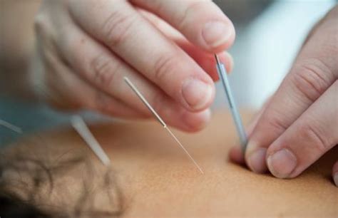 Three Edged Needle Acupuncture Services At Best Price In Jaipur Id