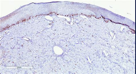 Immunohistochemical Features Of Cgct Low Proliferative Index Through Download Scientific