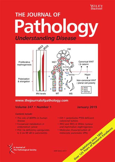 Hepatitis B Virus Large Surface Protein Is Priming For Hepatocellular