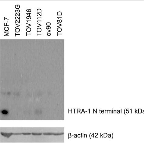 Specificity Of Anti Htra1 Antibody For Htra1 Expression Demonstrated By