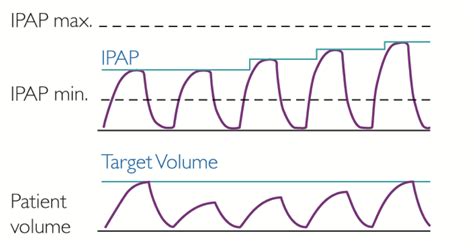 Czym są aparaty BiPAP z funkcją AVAPS iVAPS CPAP blog leczenie bezdechu sennego Ranking