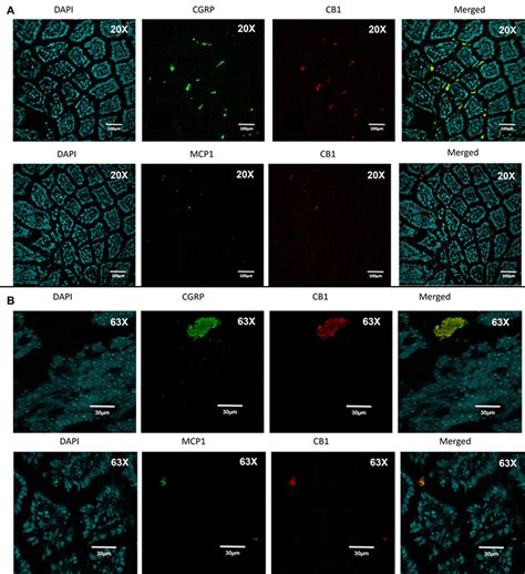 Chemogenetic Activation Of Satellite Glial Cells Reveal Their Sex Differential Roles In Visceral