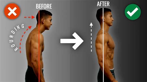 How To Fix Rounded Shoulders Fast 10 Minute Science Based Corrective Routine Youtube