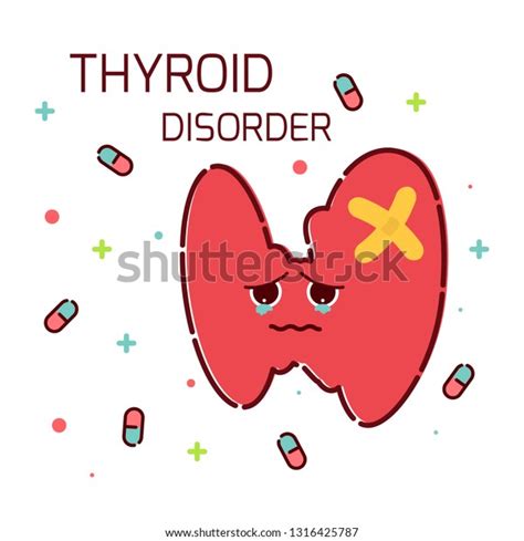 Thyroid Gland Disorder Poster Hyperthyroidism Goiter Stock Illustration 1316425787 Shutterstock