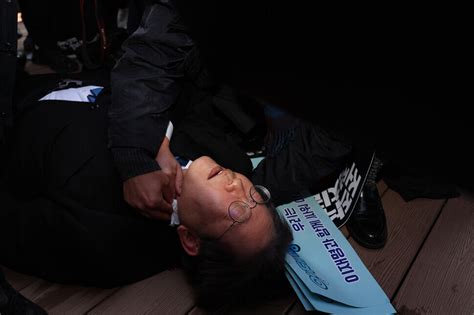 이재명 더불어민주당대표 부산 피습사건 경정맥 손상 우려