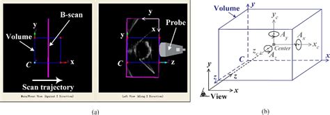 Figure 3 From Real Time Visualized Freehand 3d Ultrasound Reconstruction Based On Gpu Semantic