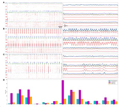 Distinct Firing Patterns In Physiological Dystonia And Epileptiform Download Scientific