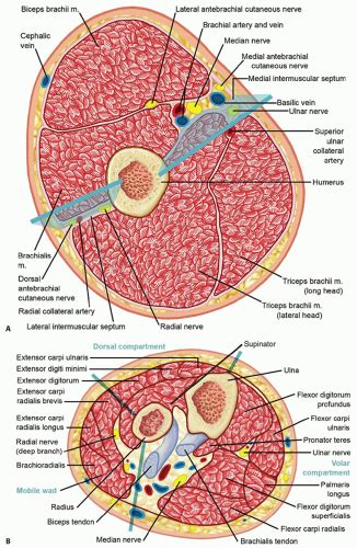 Surgical Decompression Of The Forearm Hand And Digits For Compartment
