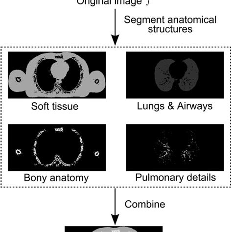 An Illustration Of How The Anatomy Segmentation Image F→seg Can Be