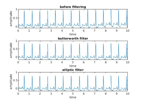 Infinite Impulse Response Butterworth Filter Vs Elliptic Filter