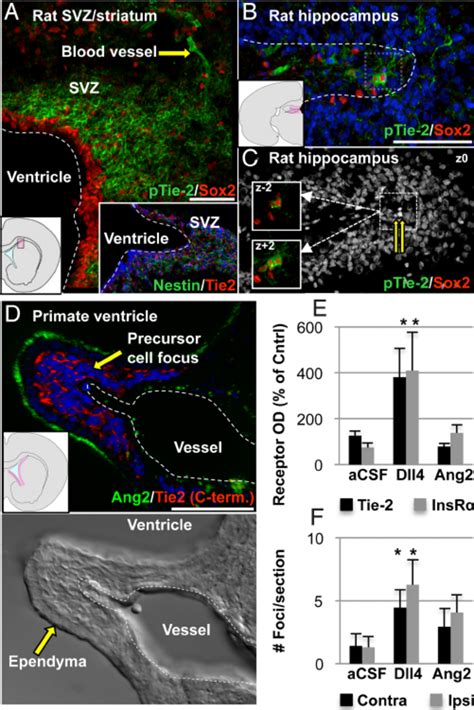 Neural Precursors In The Adult Brain Express The Tie2 Receptor A