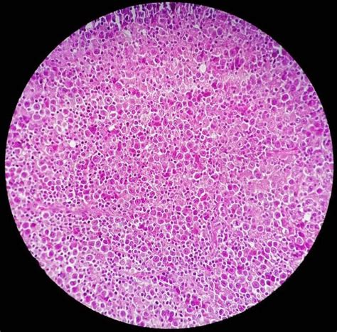 Histopathology Examination Of The Patient Download Scientific Diagram