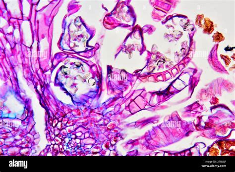 Sorus With Sporangia Of Fern Aspidium Sp Optical Microscope X200 Stock