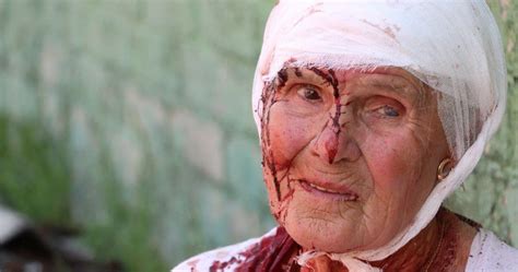 Шестеро осіб поранено від падіння уламків на Київщині серед них водій