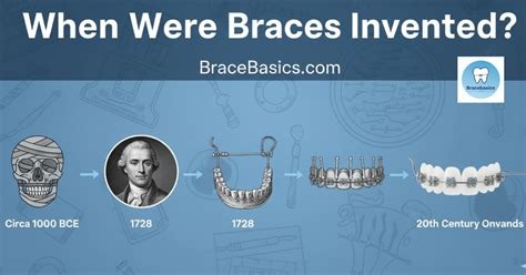 When Were Braces Invented The Complete History Of Orthodontics