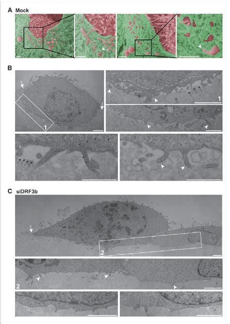 Figure 3 From Diaphanous Related Formins Are Required For Invadopodia