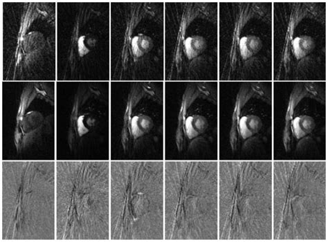 Model Based Filtered Backprojection Algorithm A Tutorial Pmc