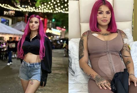 Quién Es Mona” La Influencer Mexicana Que Causó Gran Sensación Tras Someterse A Cirugía