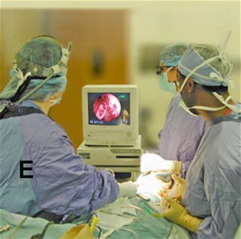 Minimally Invasive Orthognathic And Condylar Surgery Pocket Dentistry