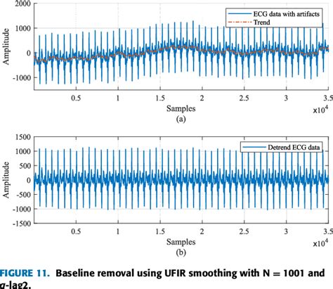 Figure 11 From Denoising And Features Extraction Of Ecg Signals In State Space Using Unbiased
